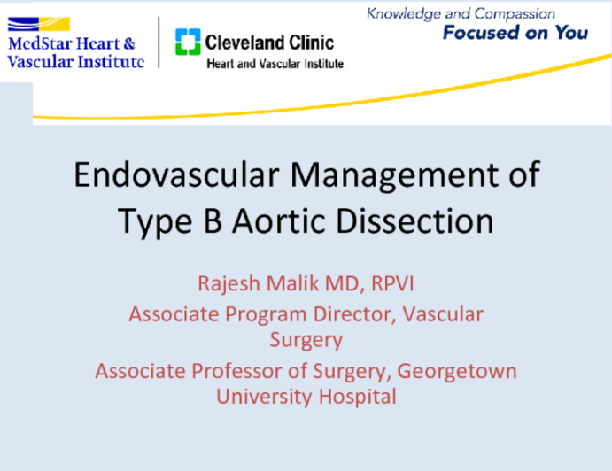 Endovascular Management of Type B Aortic Dissection | tctmd.com